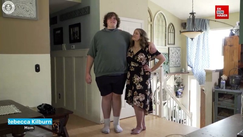 Dünyanın en büyük el ve ayaklarına sahip 15 yaşındaki Eric Kilburn ...